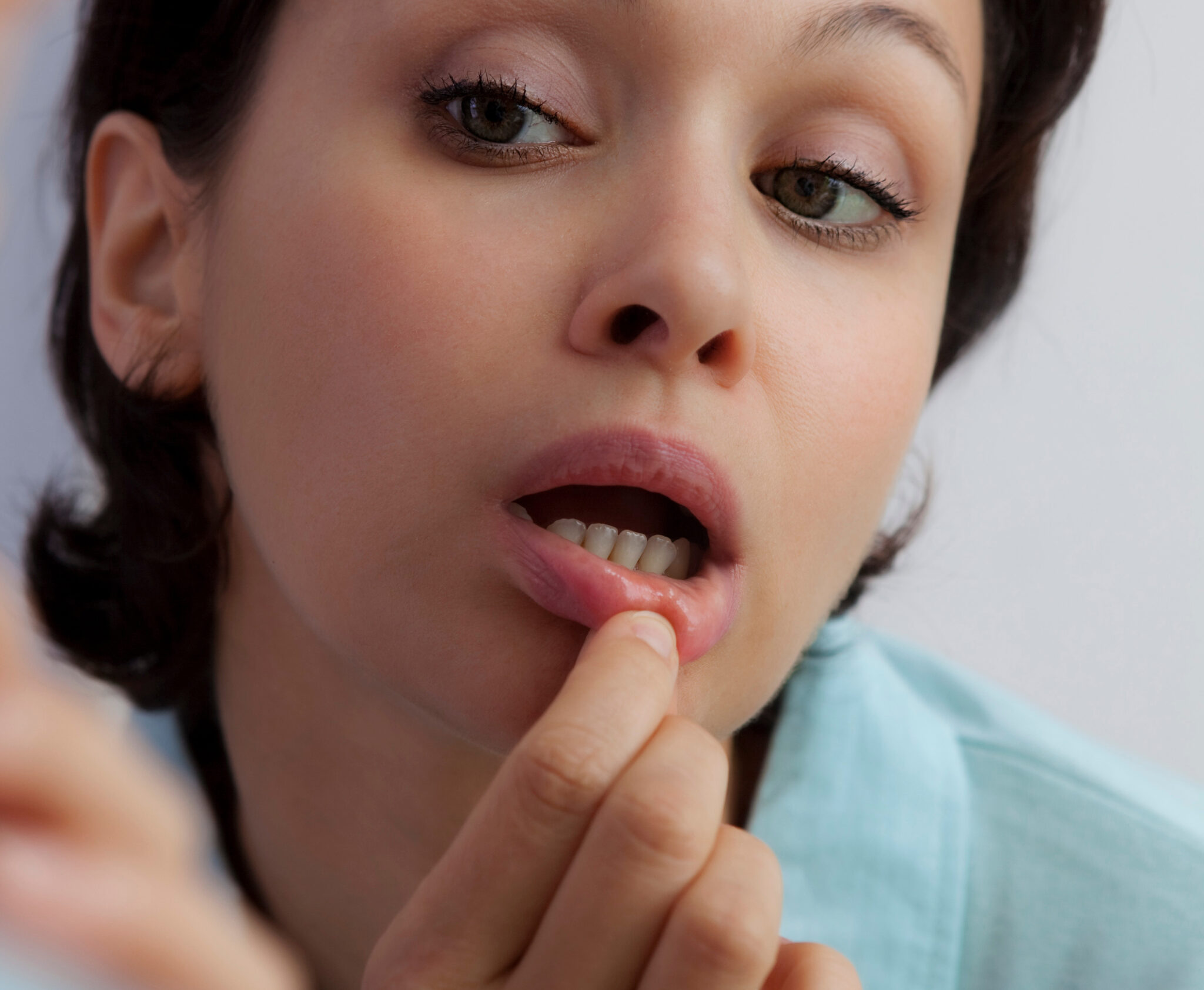 Perché vengono sempre le afte in bocca e come farle guarire in fretta ...